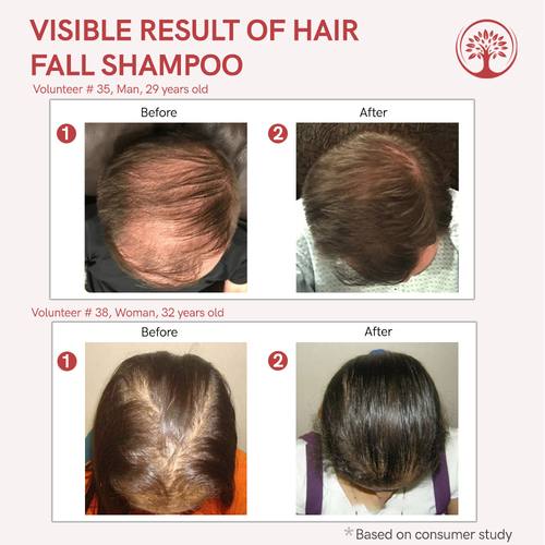 Ivory Natural Hair Shampoo Collection