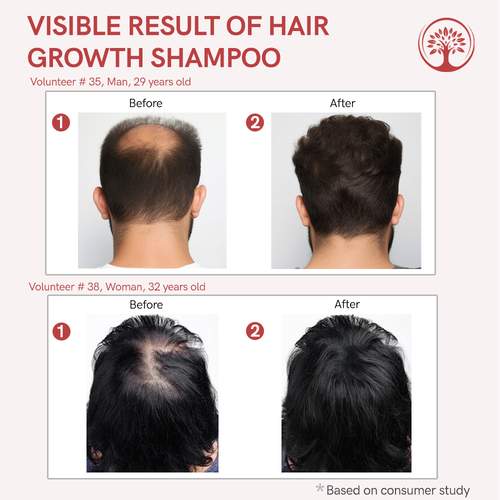 Ivory Natural Hair Shampoo Collection